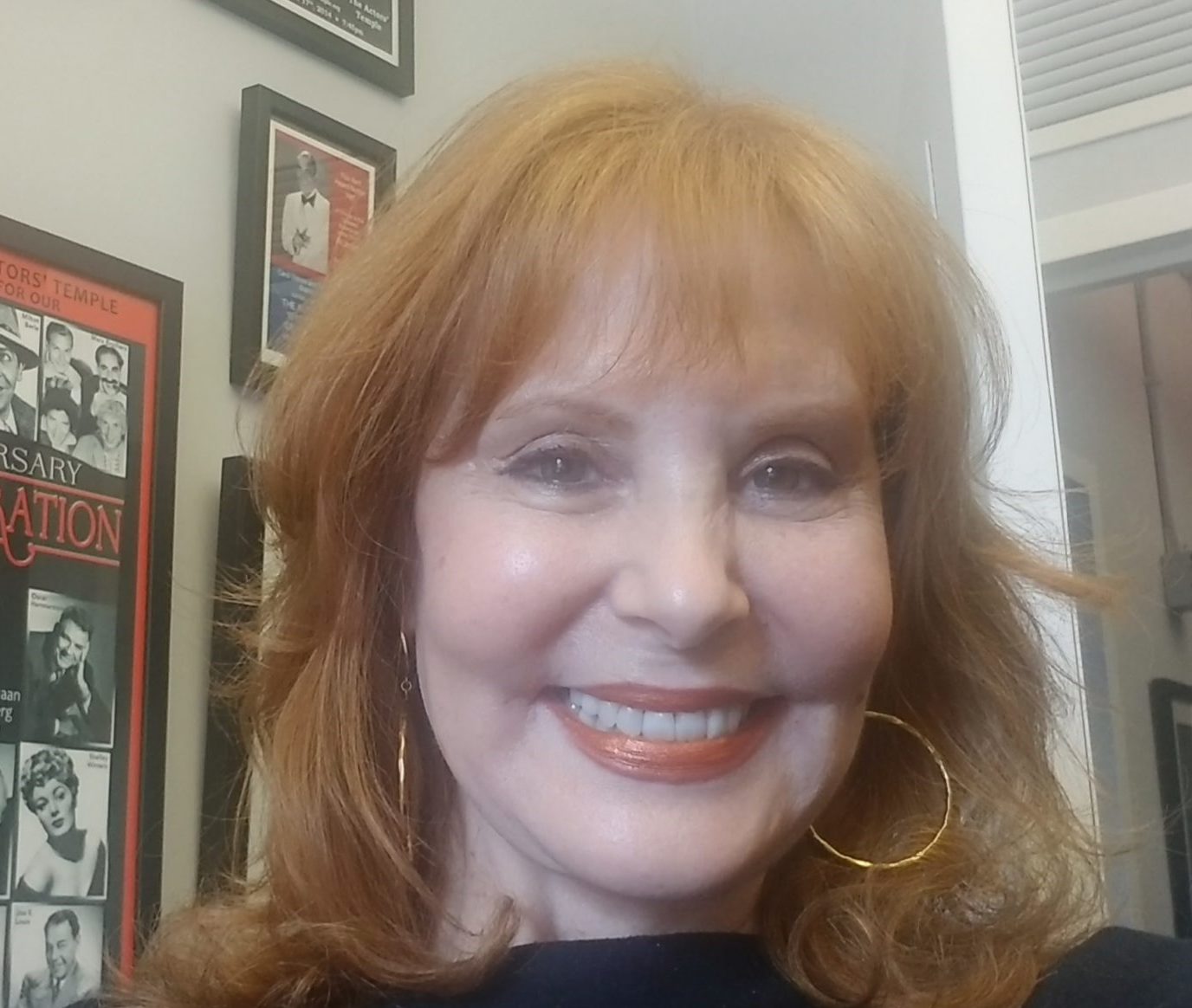 An Uplifting Experience: Why I Got a Facelift - The Three Tomatoes